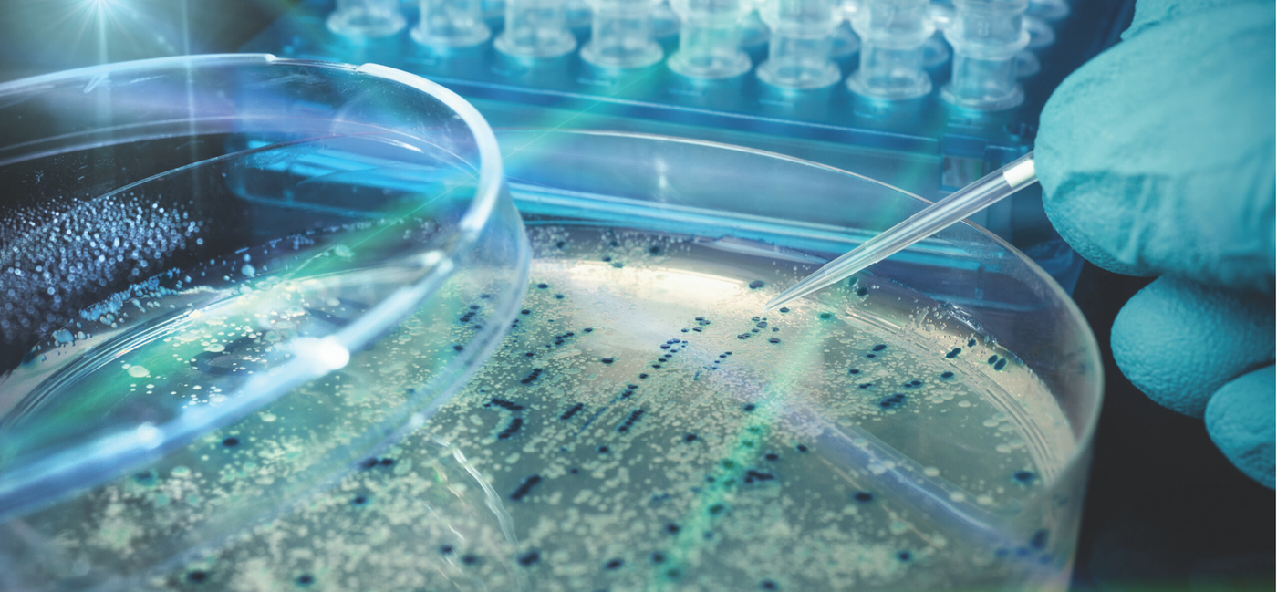 Introduction to Competent Cells – GoldBio